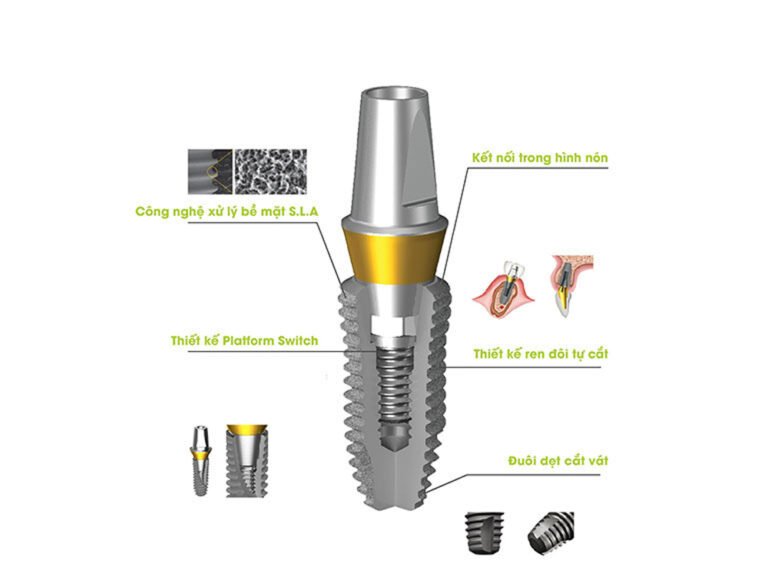 What is the best quality of Dentium Implant Korea? - New Gate Dental